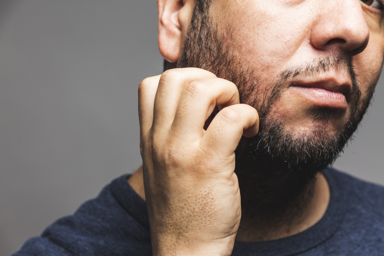 Itching Beard Six Possible Causes Enimarabic