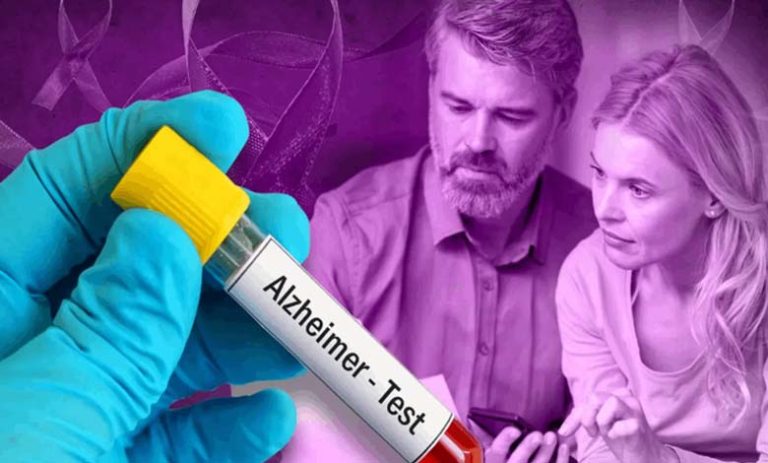 New Blood Test Platform: A Step towards Early Diagnosis of Alzheimer's ...