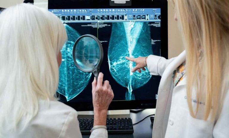 Artificial Intelligence Excels in Detecting Breast Cancer - En.ImArabic